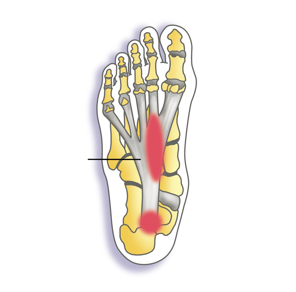 COMFORT INSOLES, EVA FOAM - SUPPORT PAD - Rayat Grup